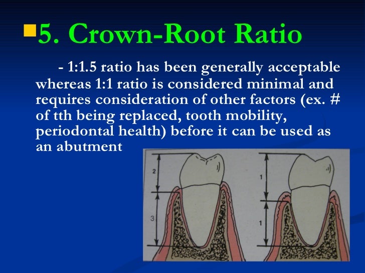 1 Fixed Partial Denture Finals1 1 Fixed Partial Denture Finals1