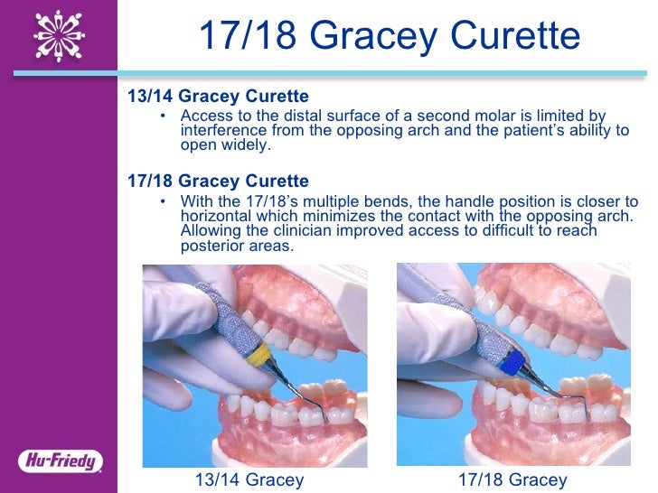 15 16 And 17 18 Gracey Fohf