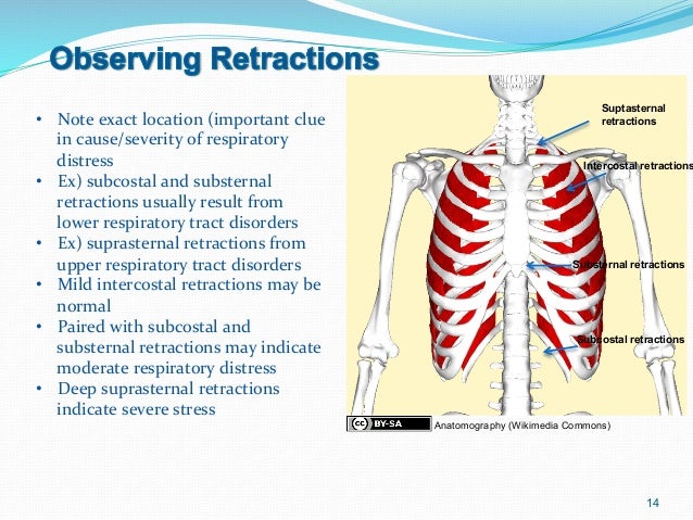 GEMC: Pediatric Respiratory Distress: Resident Training