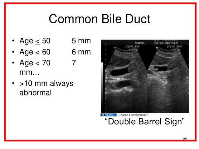 GEMC- Right Upper Quadrant Ultrasound- Resident Training