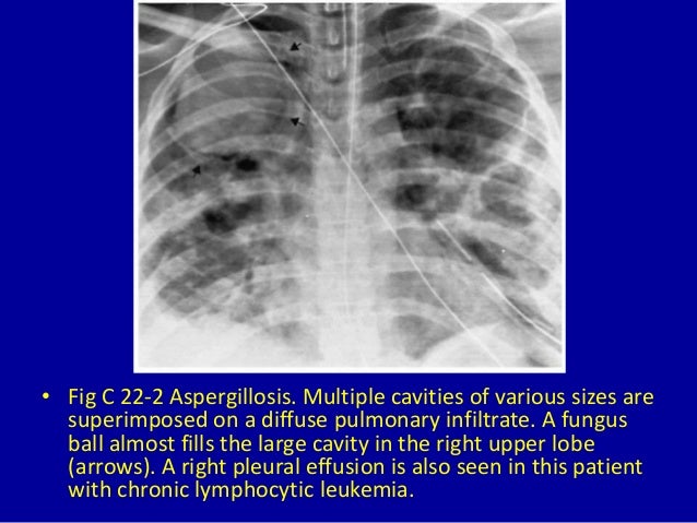 22 Meniscus Air Crescent Sign