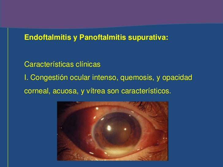 3. inflamación no granulomatosa
