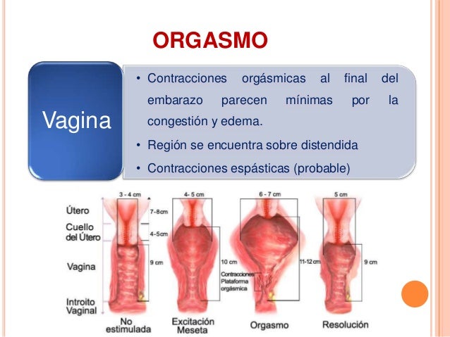 Sexualidad Ginesalud Aguascalientes
