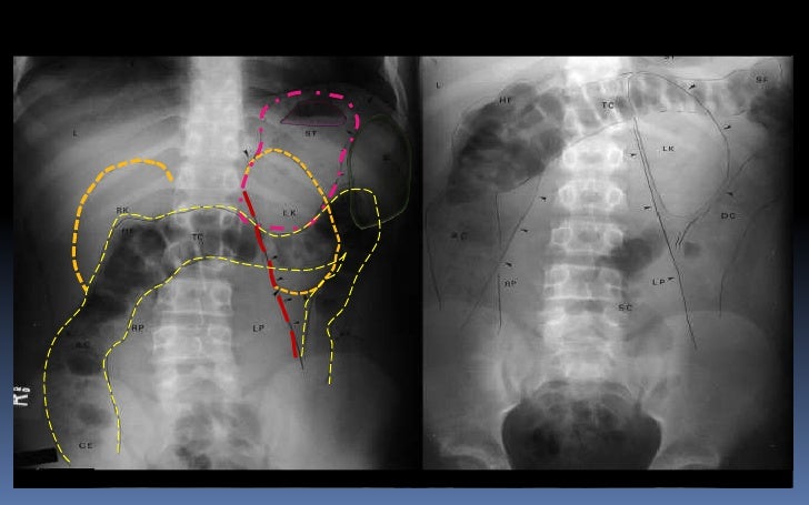 4. imagenología de abdomen clase