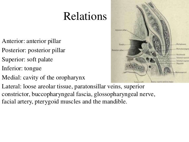 Tonsillitis