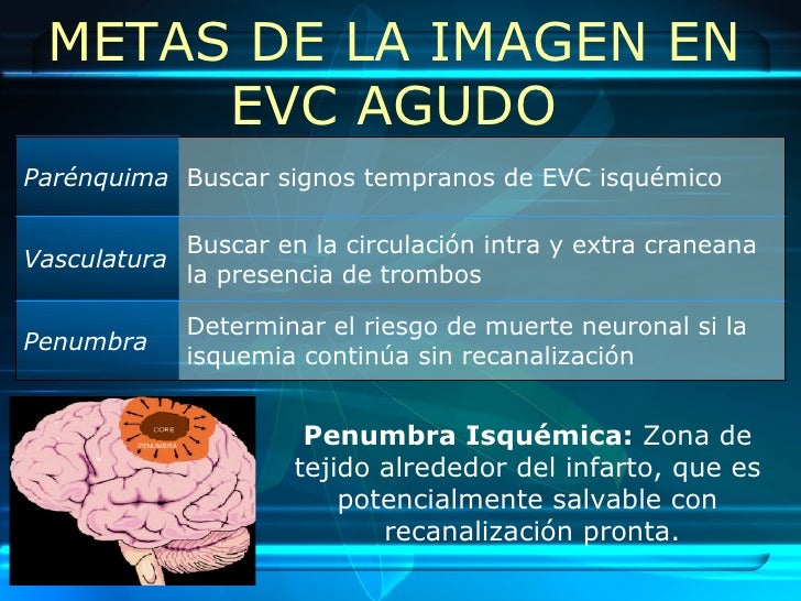 Enfermedad Vascular Cerebral