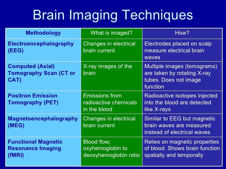 Overview of Neuroeconomics
