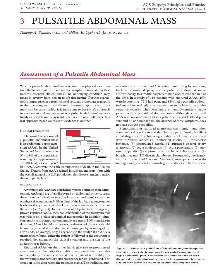 Acs0603 Pulsatile Abdominal Mass