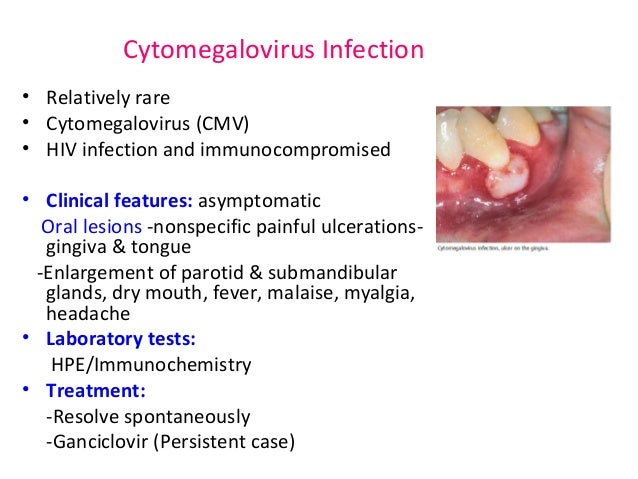 Acute Cytomegalovirus Cmv Infection As Related To Dermatitis Pictures