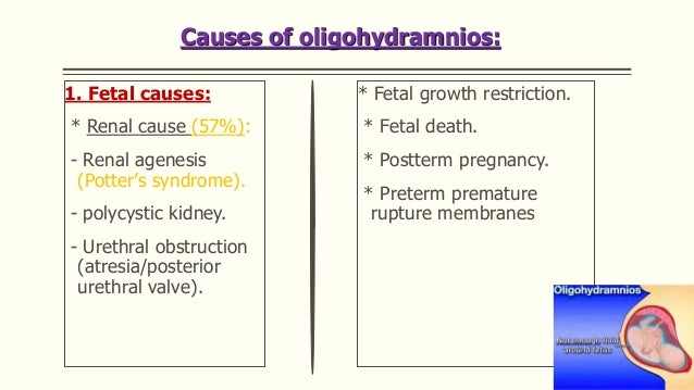 Amniotic fluid disorder