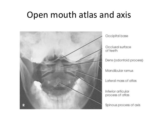 All projections Anatomy