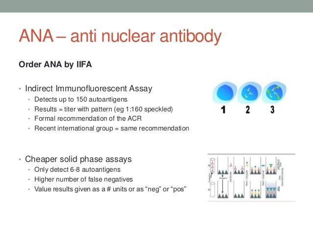 Connective Tissue Diseases