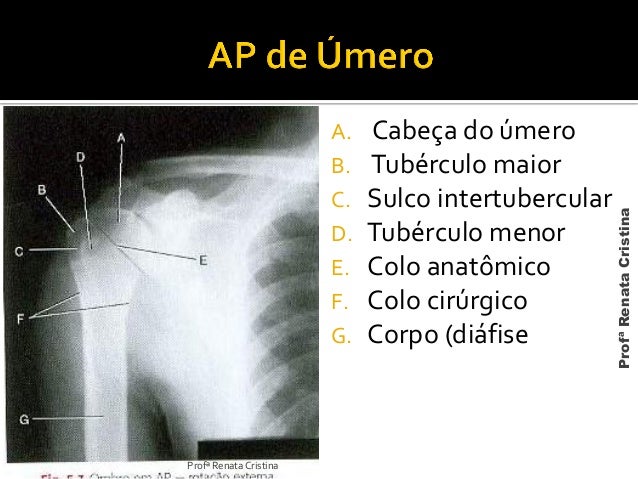 Anatomia Radiológica