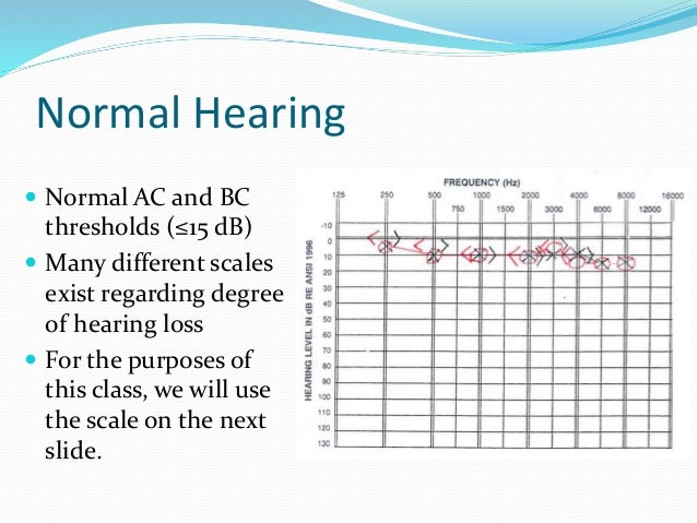 Audiogram interpretation