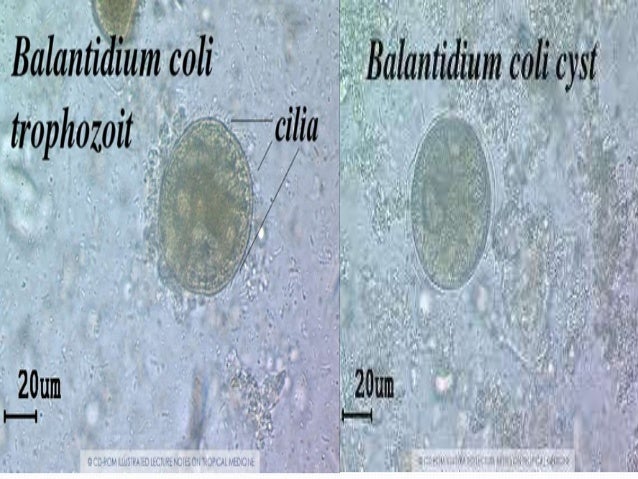 Balantidium Coli