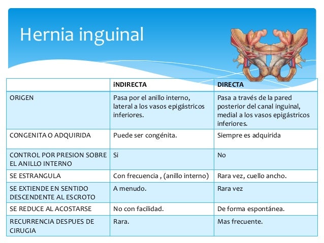 Canal inguinal y hernias
