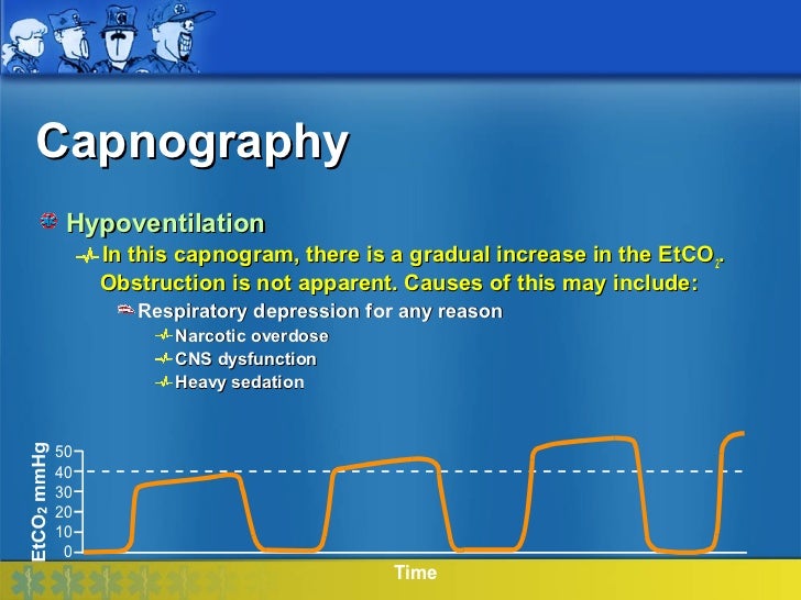 Capnography