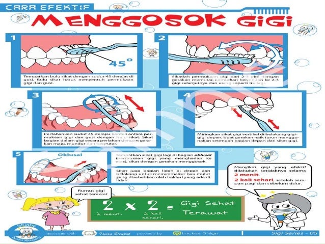 Cara menggosok gigi