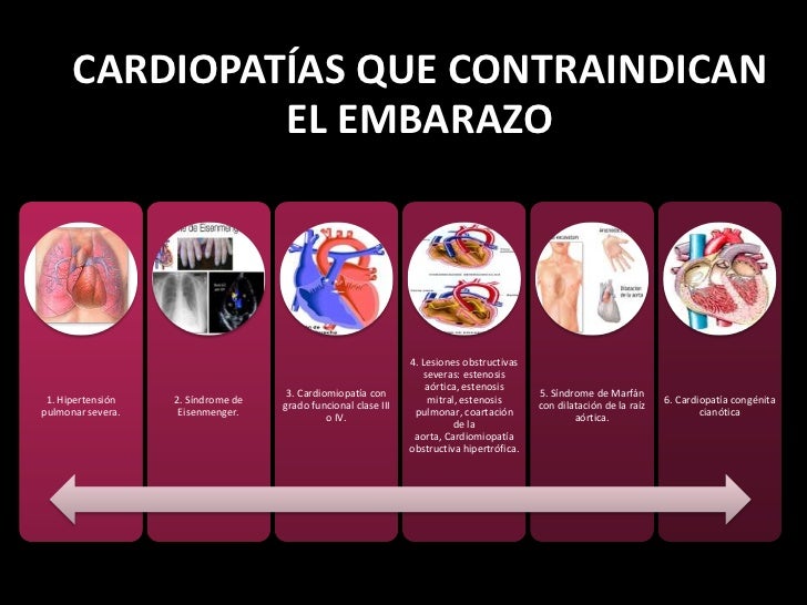 Cardiopatías En El Embarazo