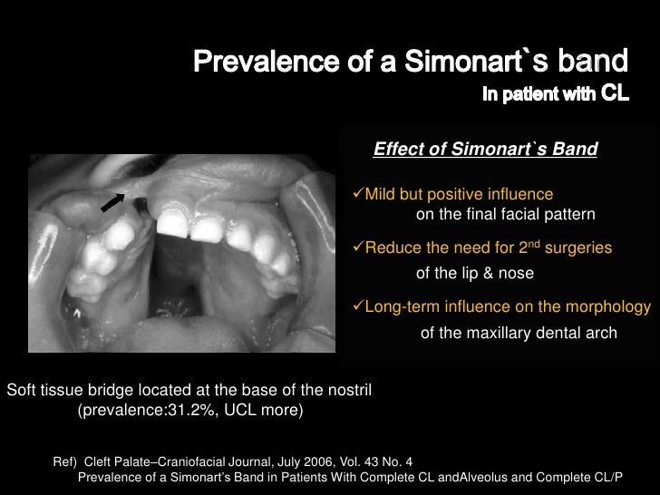 Case review(cleft lip)