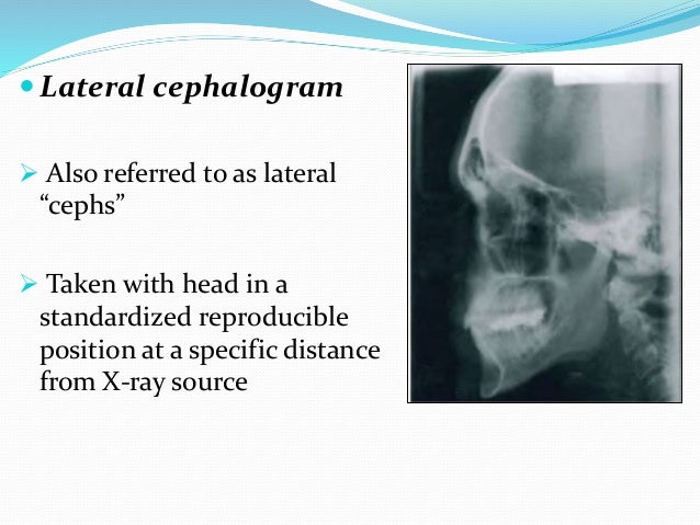 Cephalometrics