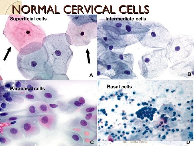 Cervical cytopathology