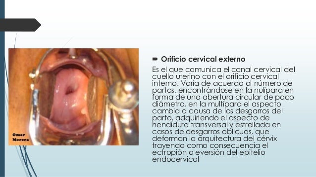 Cervix uterino y papanicolaou