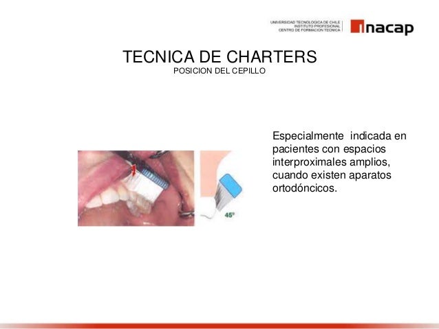 Clase 5 tratamiento periodontal higienene bucal