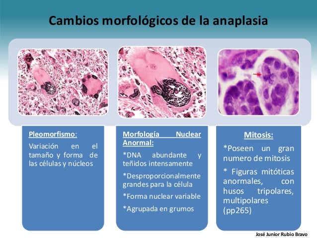 Clasificación de las neoplasias benignas y malignas Clasificación de las neoplasias benignas y malignas