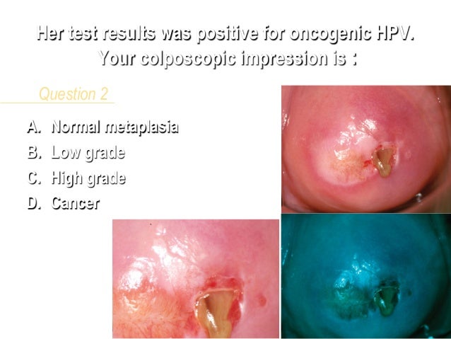 Colposcopy case studies2