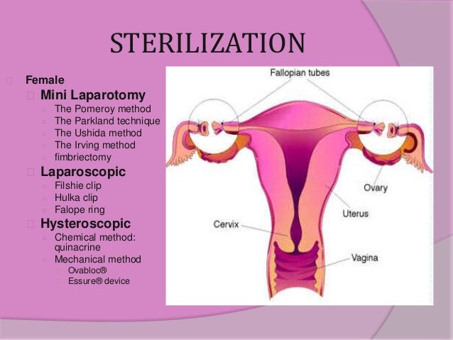Contraception