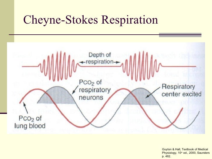 Cheyne-Stokes Respiration