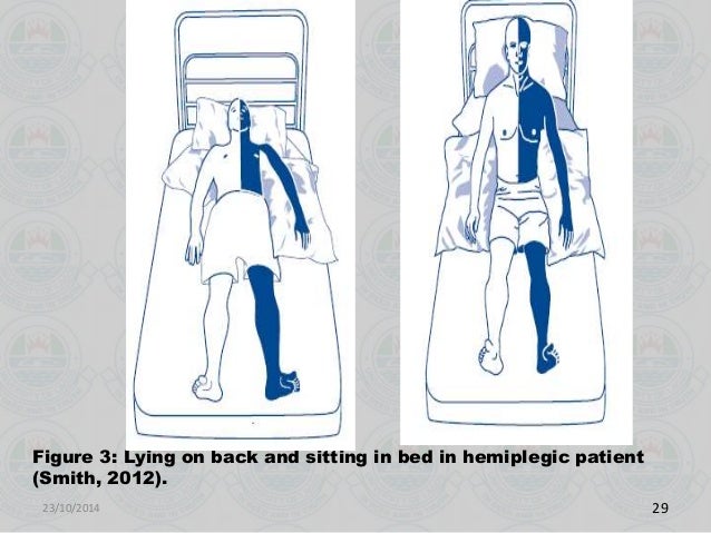 hemiplegic shoulder pain