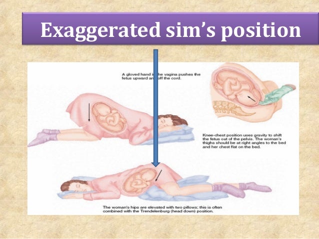 Cord prolpase for undergraduate