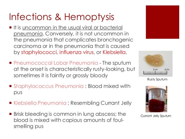 Cough And Hemoptysis