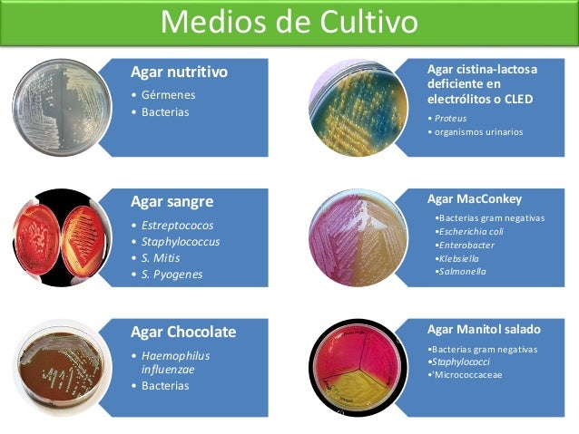 Mediso de cultivo & Crecimiento bacteriano