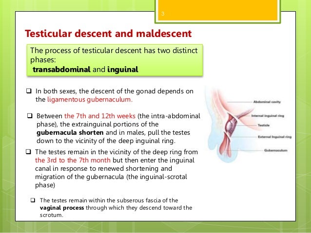 Undescended Testis Cryptorchidism