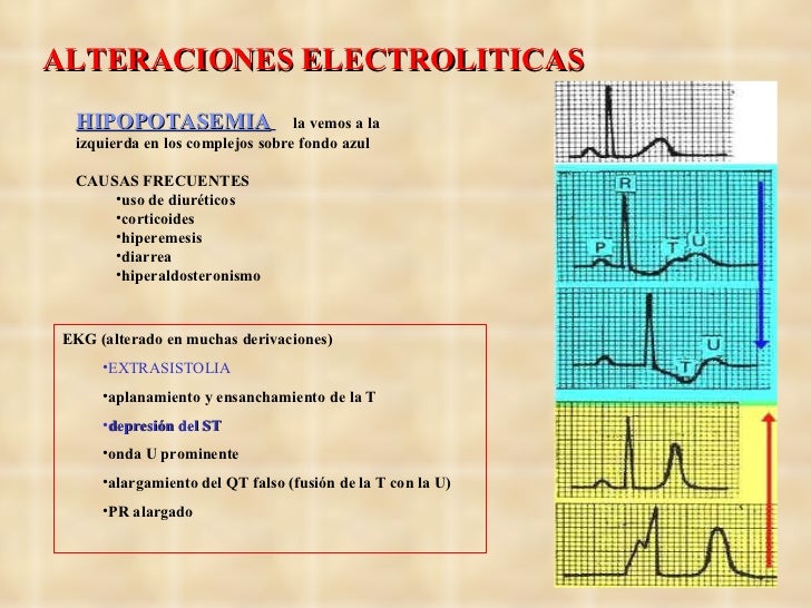Curso EKG