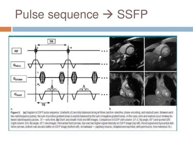 Cardiac MRI principle