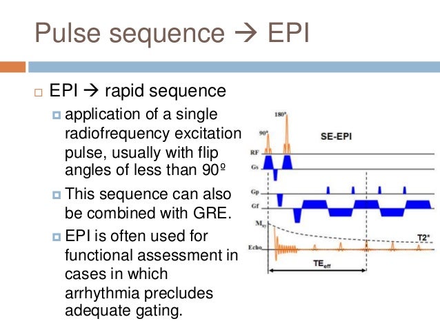 Cardiac MRI principle
