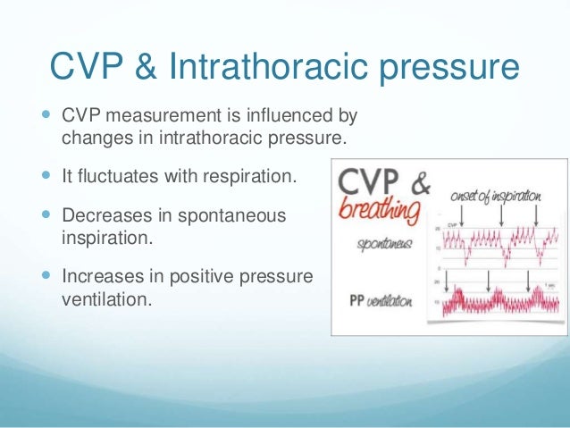 CVP Pulmonary artery wedge pressure monitoring: Physiology