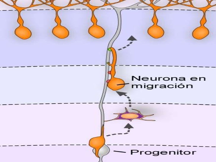 Defectos migracion neuronal