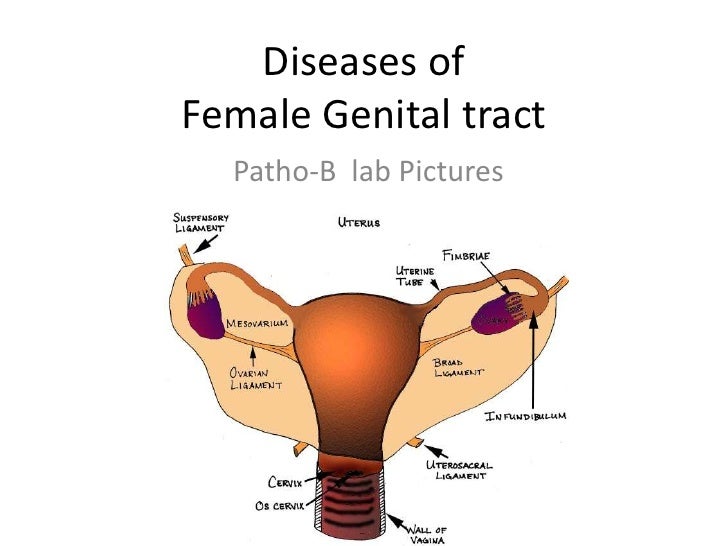Diseases Of Female Genital Tract