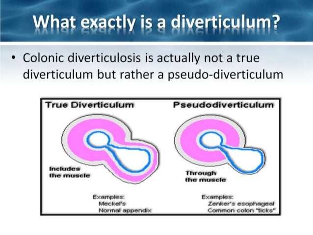 Diverticular disease of the colon