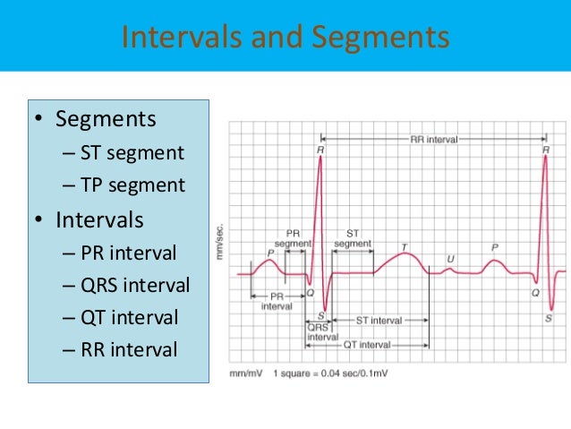 Electrocardiogaram - ECG EKG