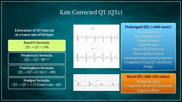 Electrocardiogram