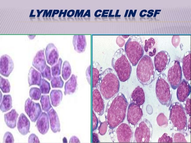 Evaluation Of Csf