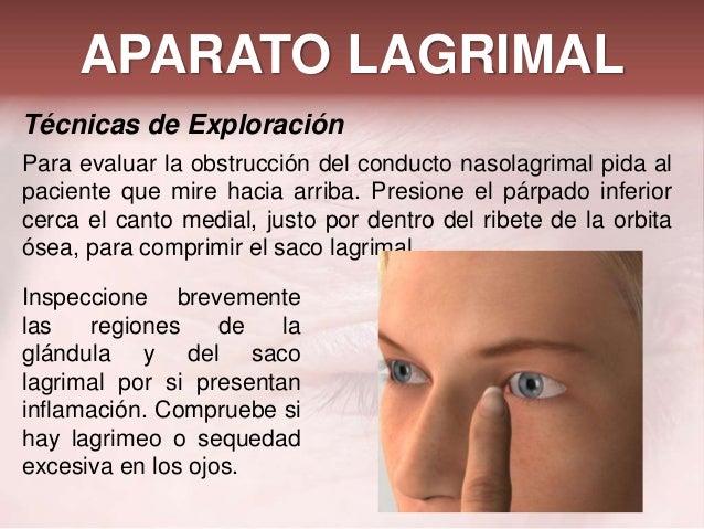Examen De Ojo