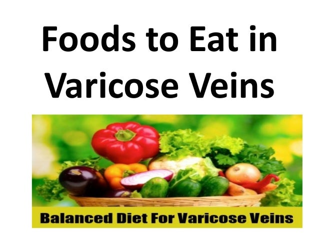 Foods To Eat And Avoid In Varicose Veins