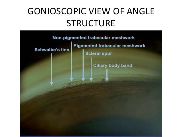 Gonioscopy